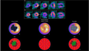 Customer Success - INVIA