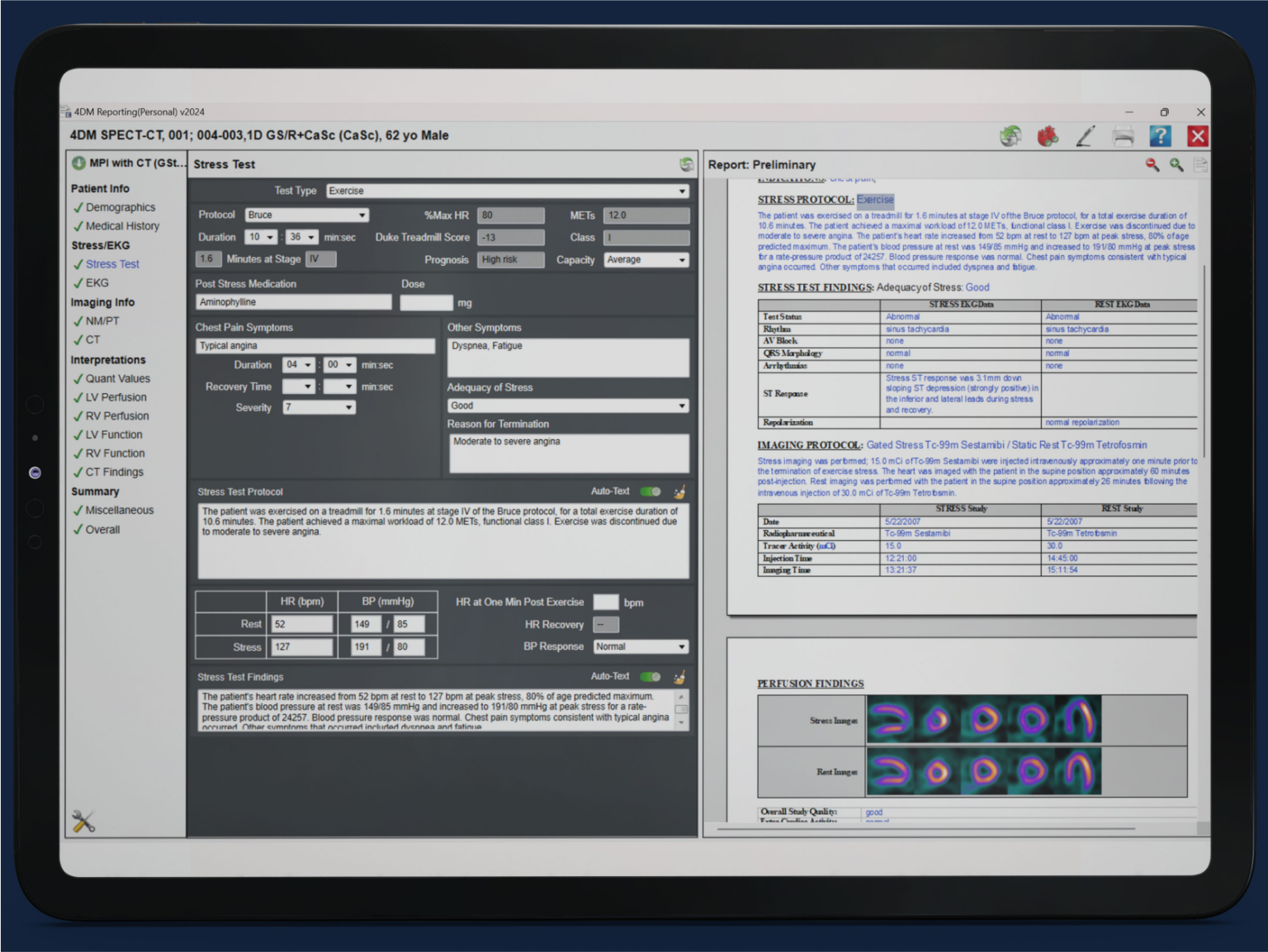 4DM Software - INVIA